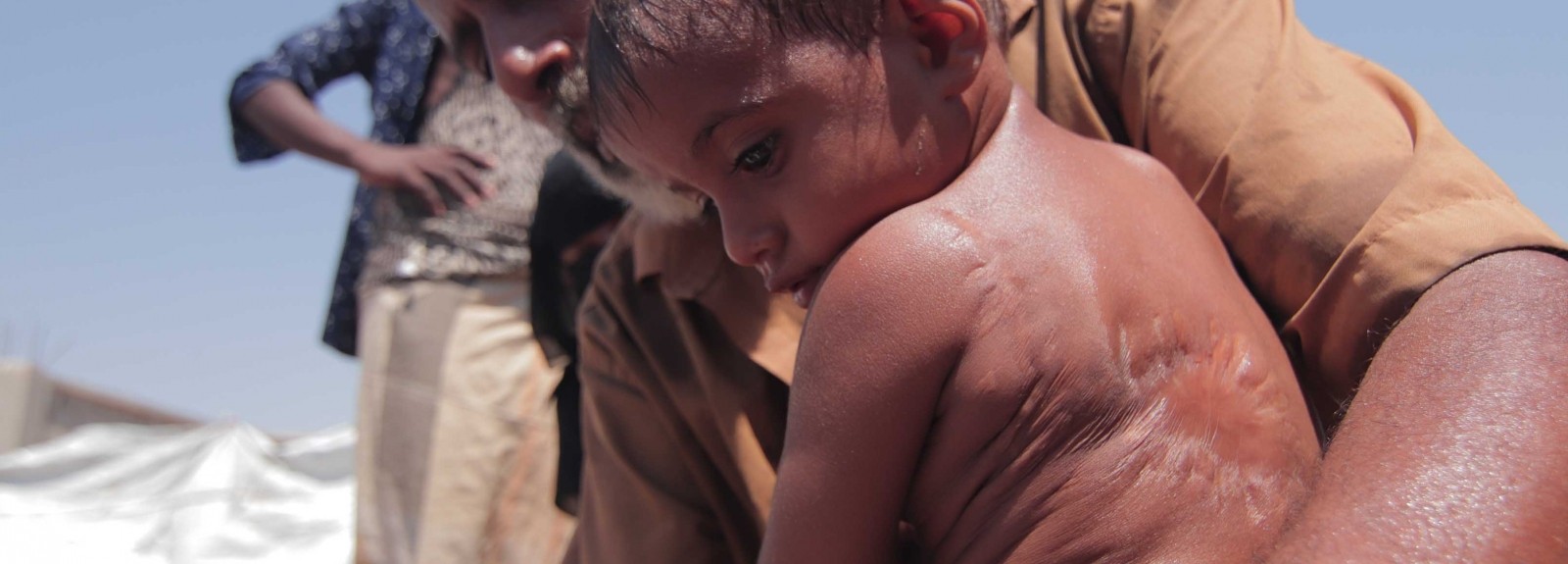 The shrapnel in her back didn't kill her. But without your help, she ...